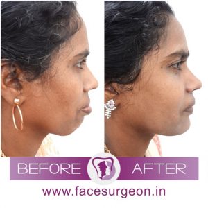 Different Types of Jaw Problems and How Are They Resolved